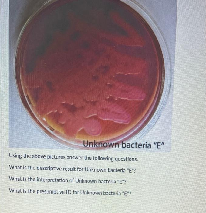 Solved MacConkey agar (4-4) MacConkey Agar Uninoculated | Chegg.com