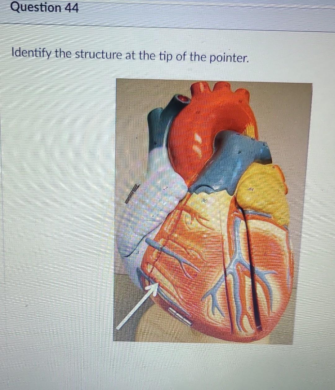 Solved Identify the vessel at the tip of the | Chegg.com