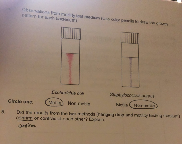 Observations from motility test medium (Use color | Chegg.com