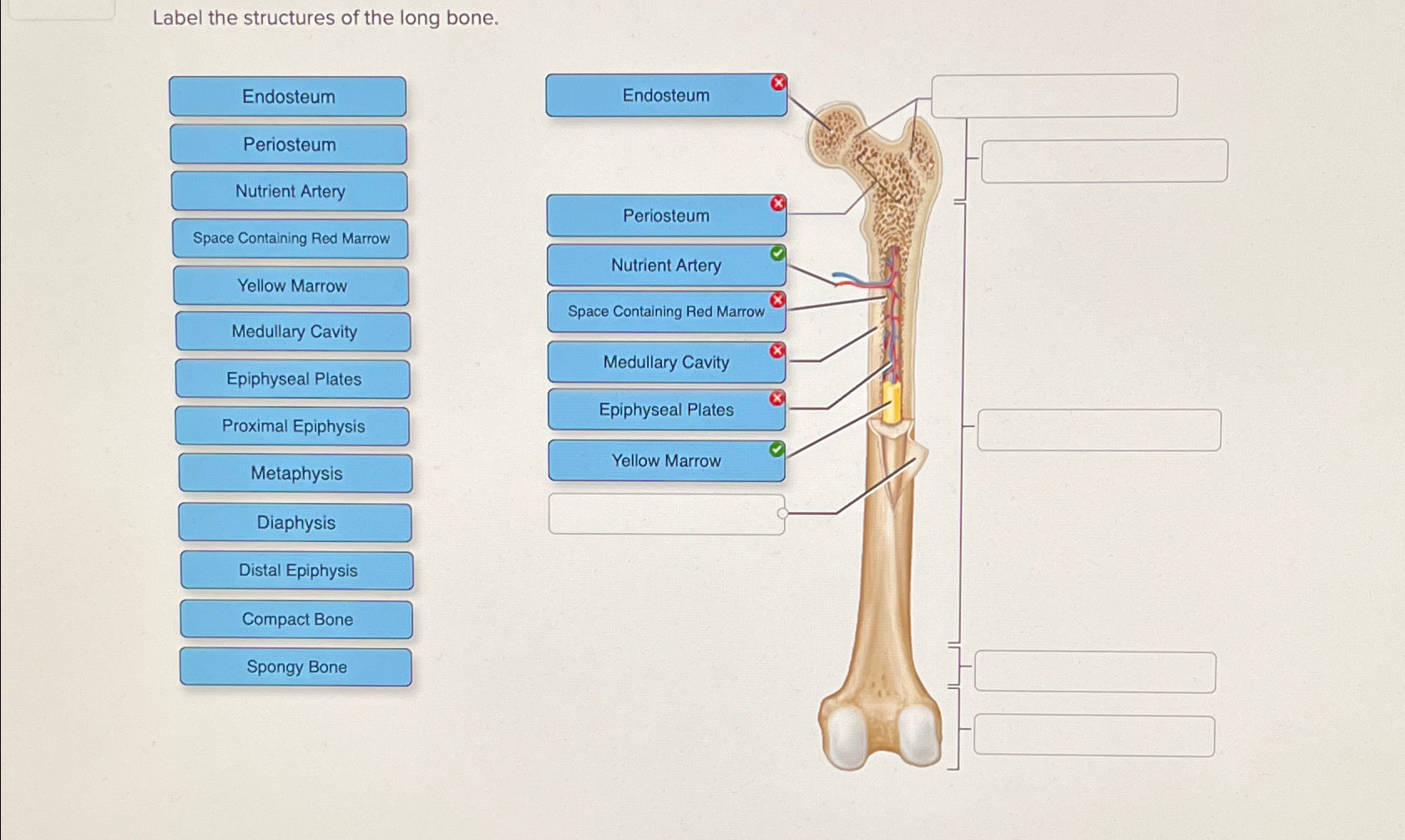 Solved Label the structures of the long bone. | Chegg.com