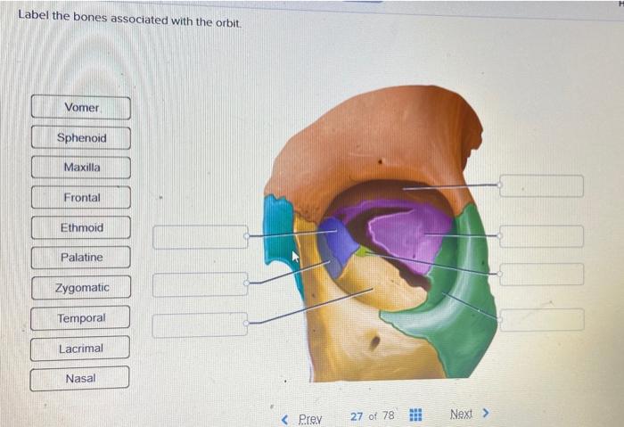 Solved Label the bones associated with the orbit. Vomer | Chegg.com