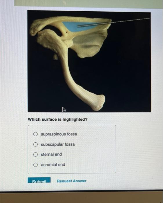Solved Which surface is highlighted? O supraspinous fossa O | Chegg.com