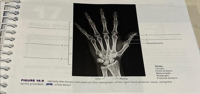 Solved FIGURE 16.9 Identify the bones indicated on this | Chegg.com
