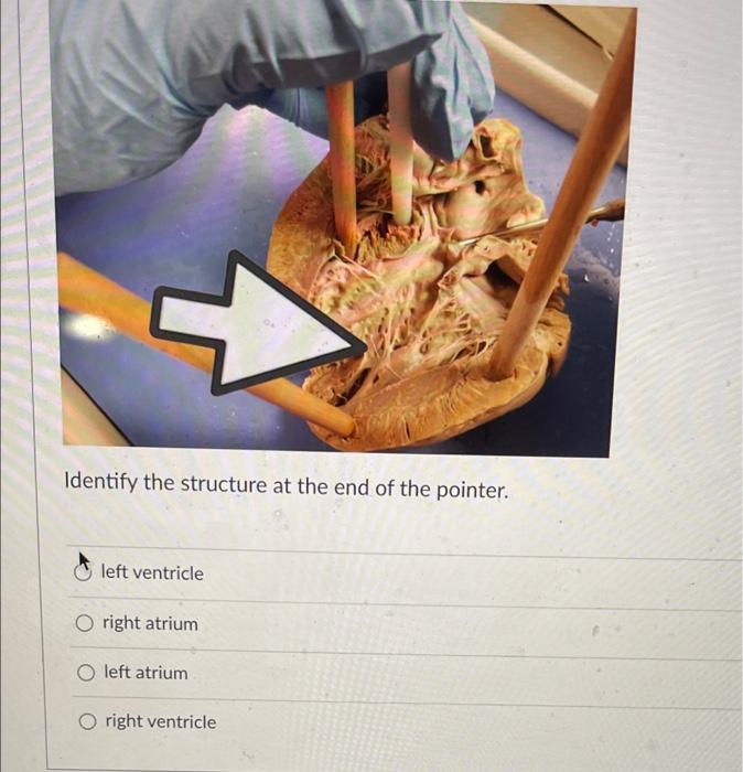 Solved Identify the structure at the end of the pointer. | Chegg.com