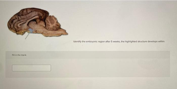 Solved Identify the embryonic reglon after 5 weeks, the | Chegg.com