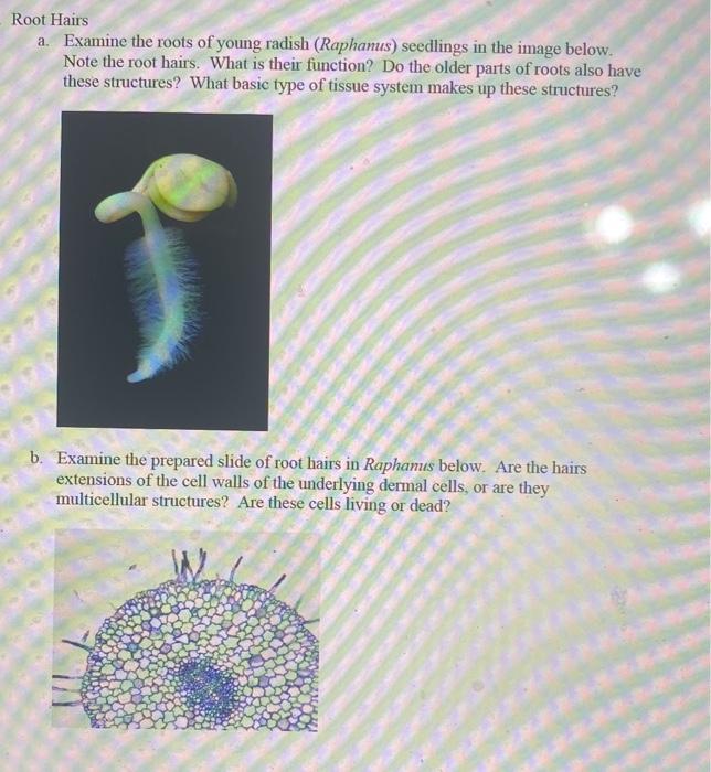 Solved Root Hairs a. Examine the roots of young radish | Chegg.com