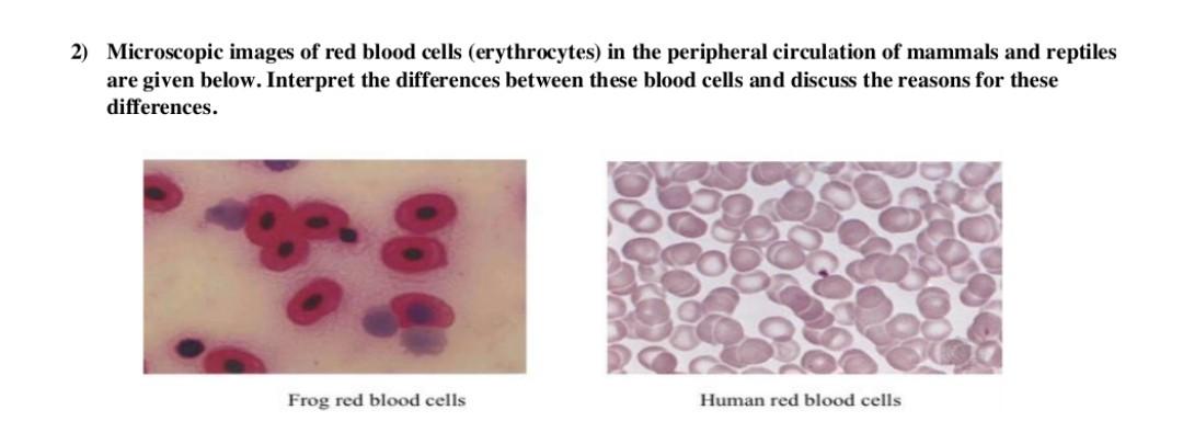 Solved 2) Microscopic images of red blood cells | Chegg.com