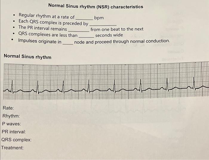 Normal Sinus rhythm (NSR) characteristics - Regular | Chegg.com