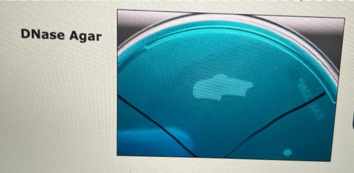 Solved Describe your observations of the DNase Agar test: a. | Chegg.com