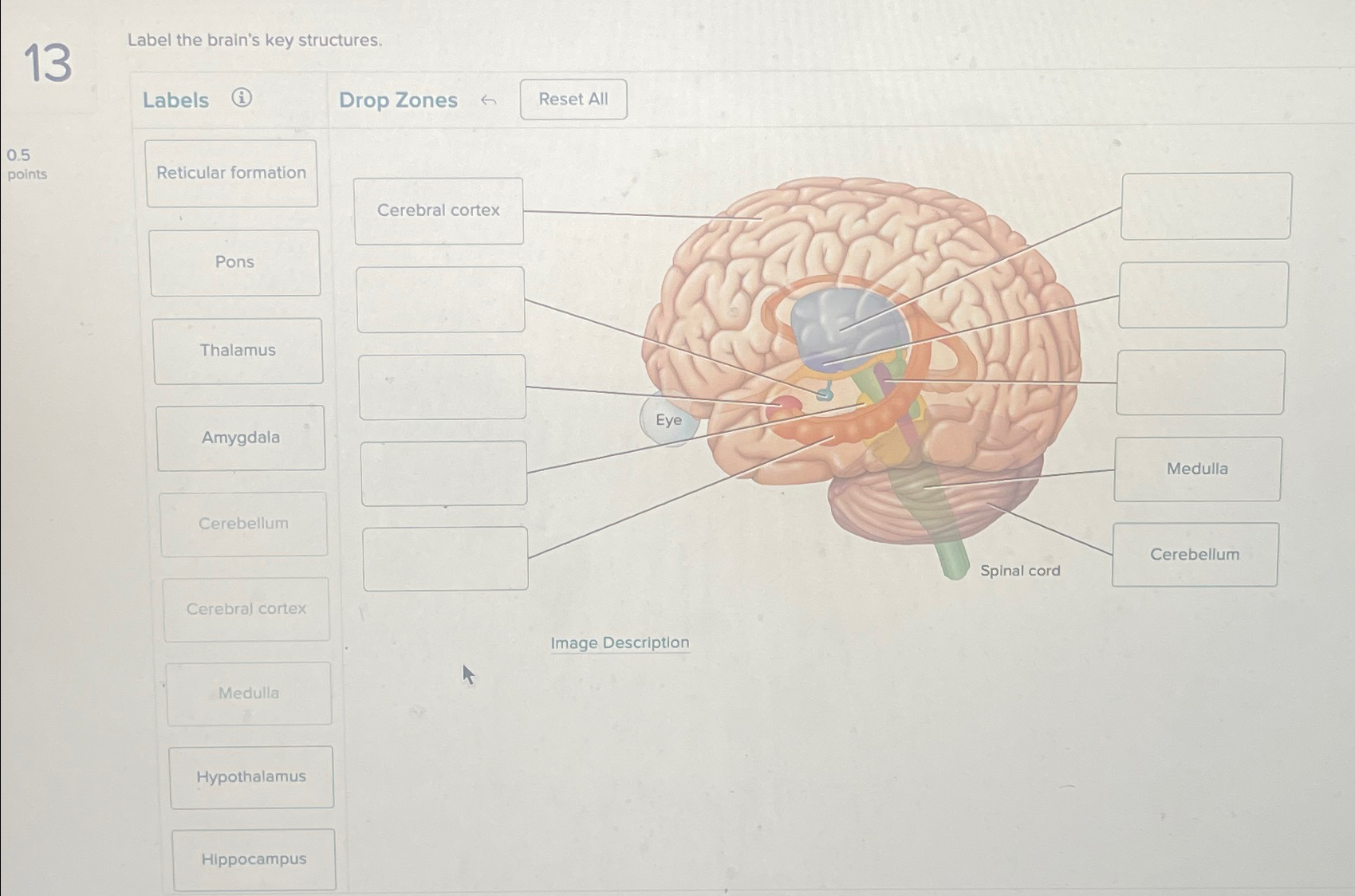 Solved 13Label the brain's key structures.Labels(i)Drop | Chegg.com