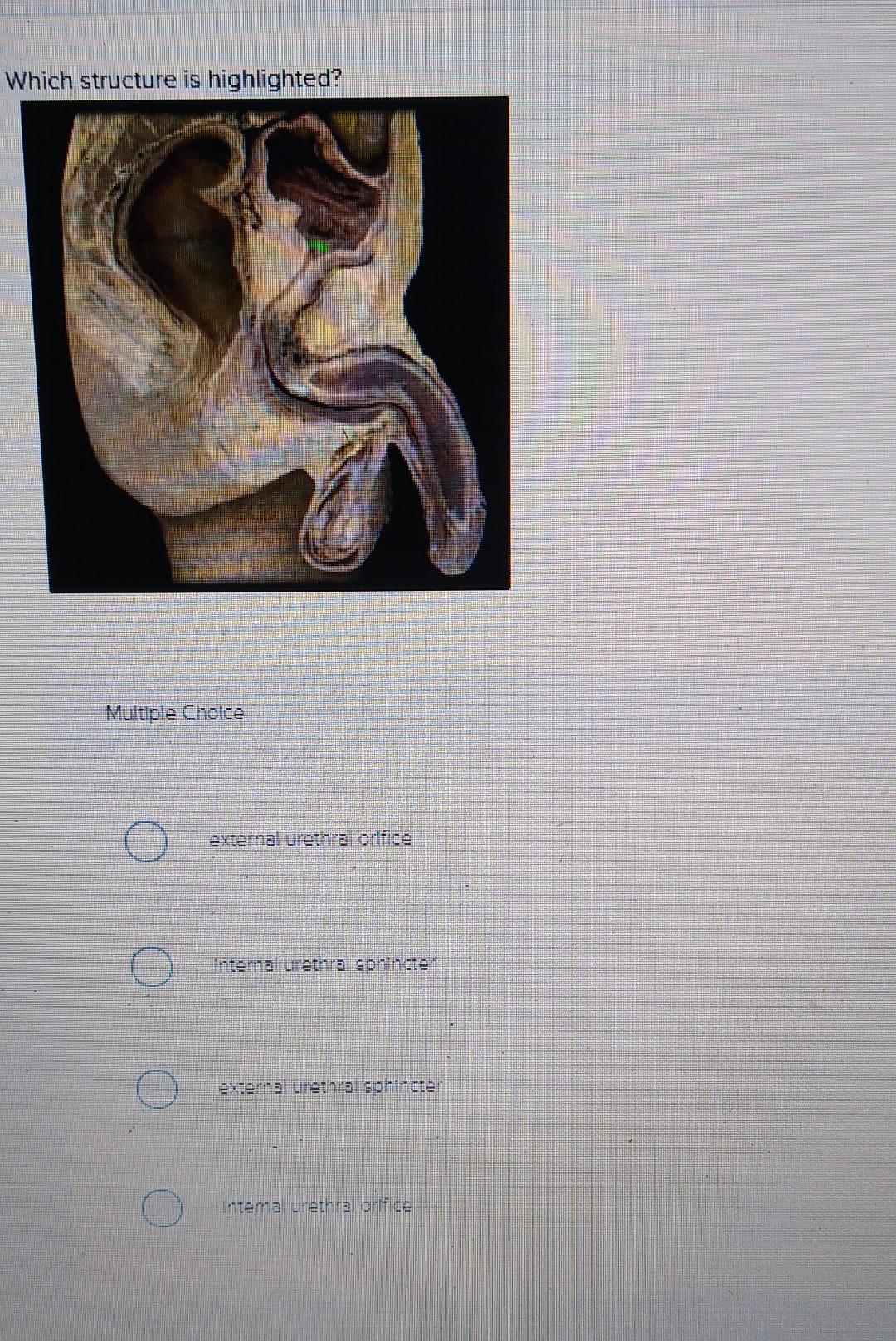 Solved Label the structures of the thorax based on the hints | Chegg.com