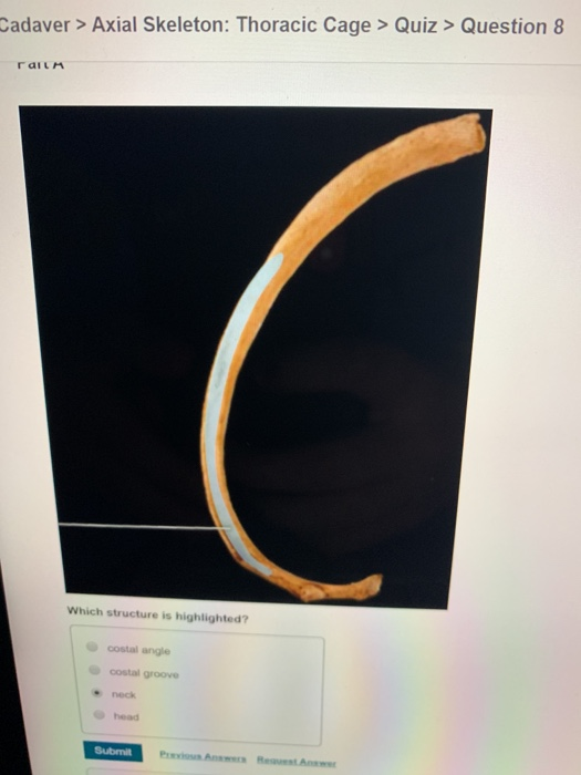 Solved: Cadaver > Axial Skeleton: Thoracic Cage > Quiz > Q... | Chegg.com