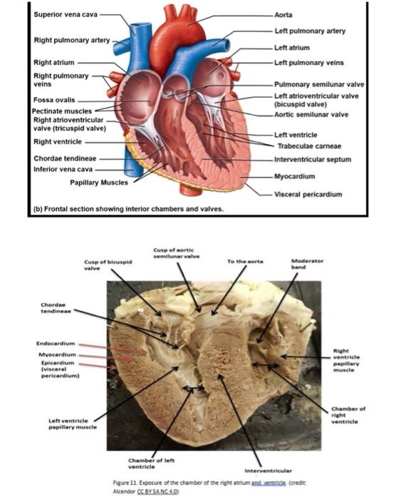 Solved 10. Identify the papillary muscles. How many are | Chegg.com