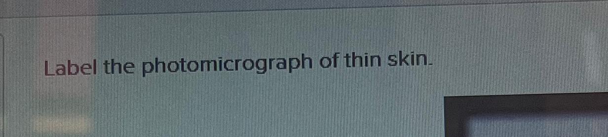 Solved Label the photomicrograph of thin skin. | Chegg.com