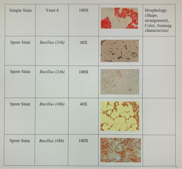 Simple Stain Yeast 6 100X Morphology (Shape, | Chegg.com