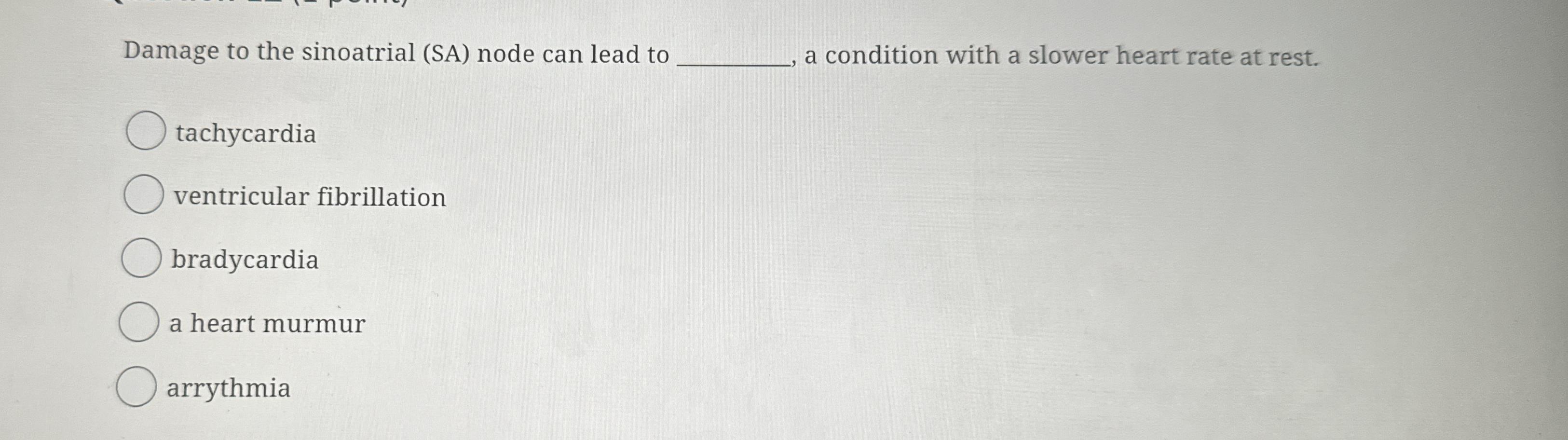 Solved Damage to the sinoatrial (SA) ﻿node can lead to , ﻿a | Chegg.com