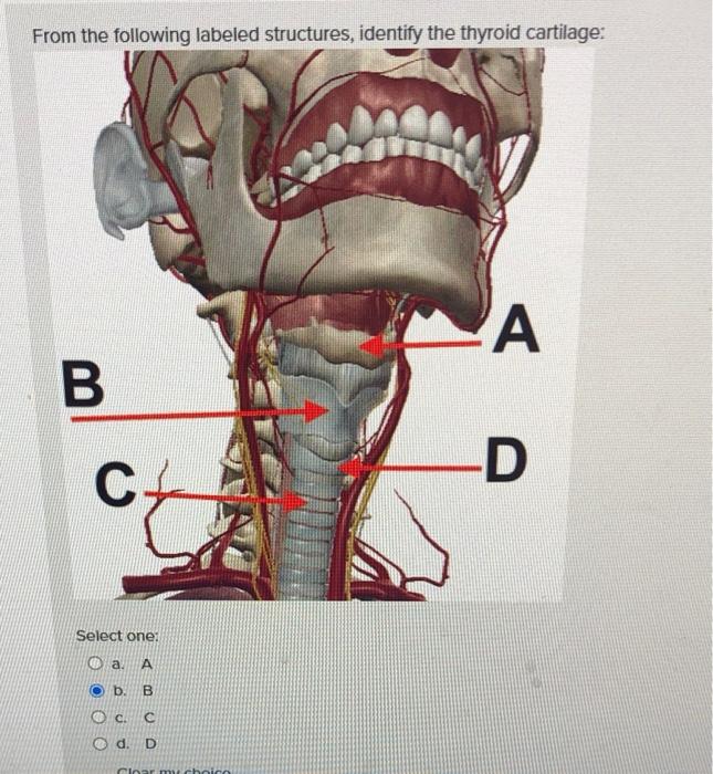 Solved From the following labeled structures, identify the | Chegg.com