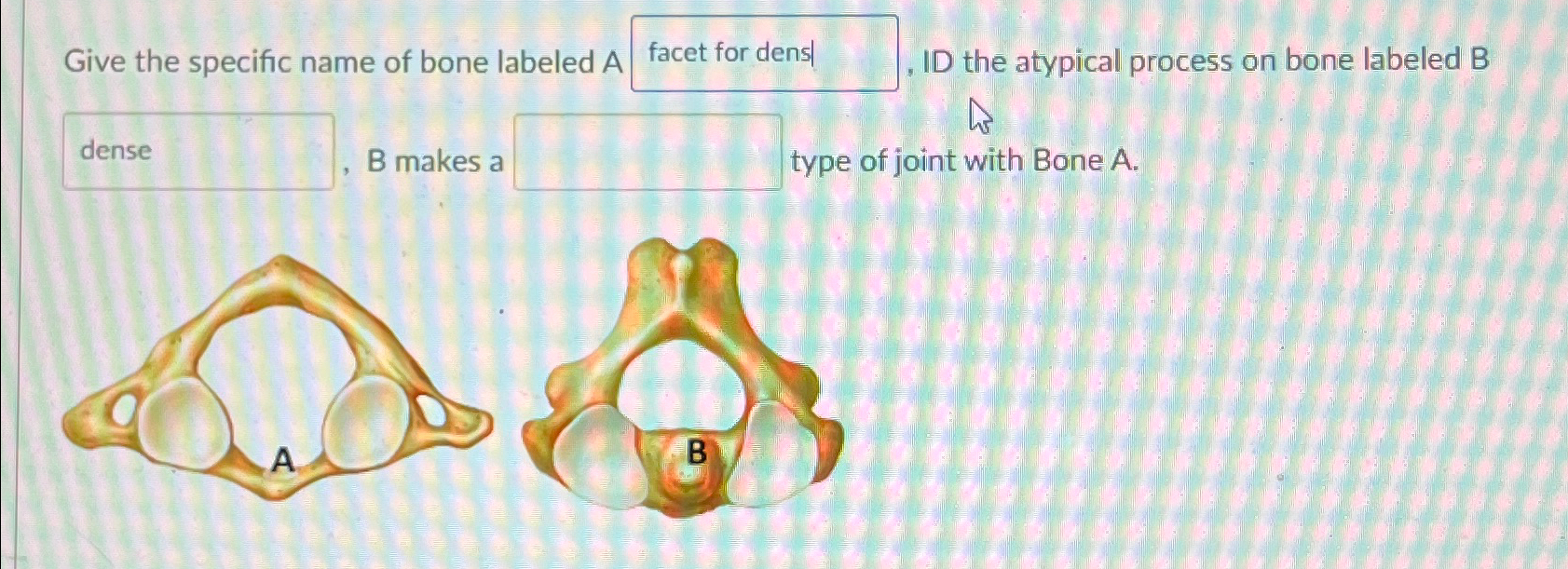 Solved Give the specific name of bone labeled A , ﻿ID the | Chegg.com