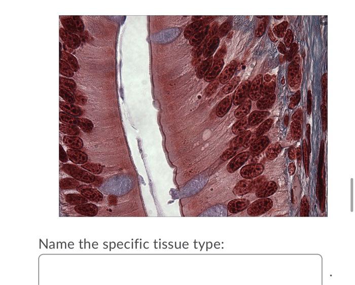 Solved + 1. General tissue type: EPITHELIAL Specific tissue | Chegg.com