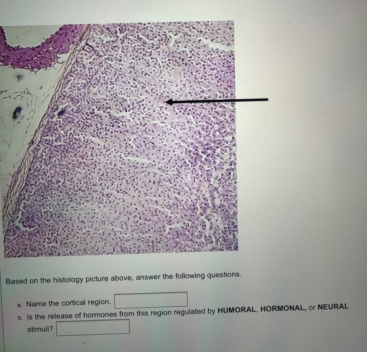 Solved Based on the histology picture above, answer the | Chegg.com