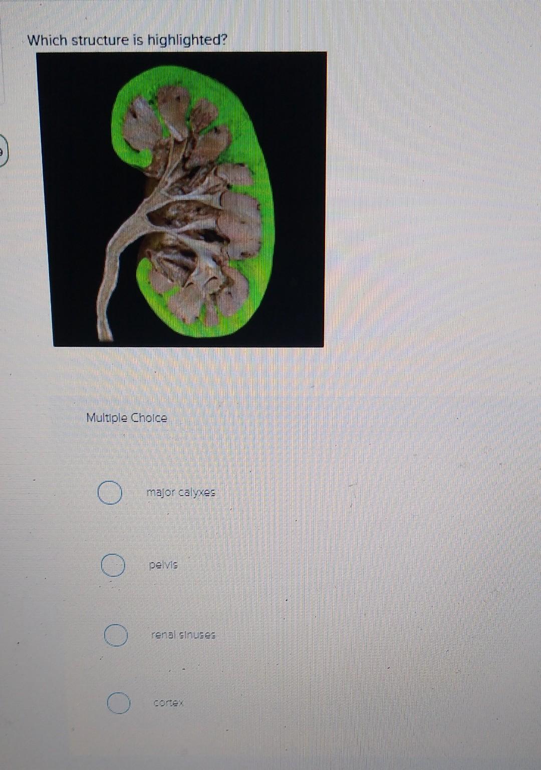 Solved Which structure is highlighted? Multiple Choice major | Chegg.com