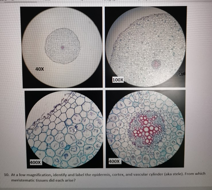 Solved 40X 100X 400X 400x 10. At a low magnification, | Chegg.com