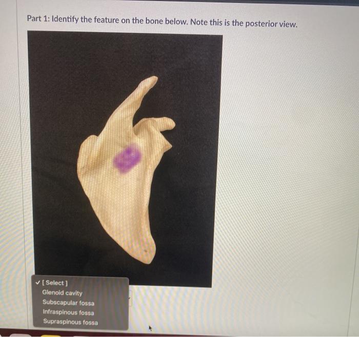 Solved Part 1: Identify the feature on the bone below. Note | Chegg.com