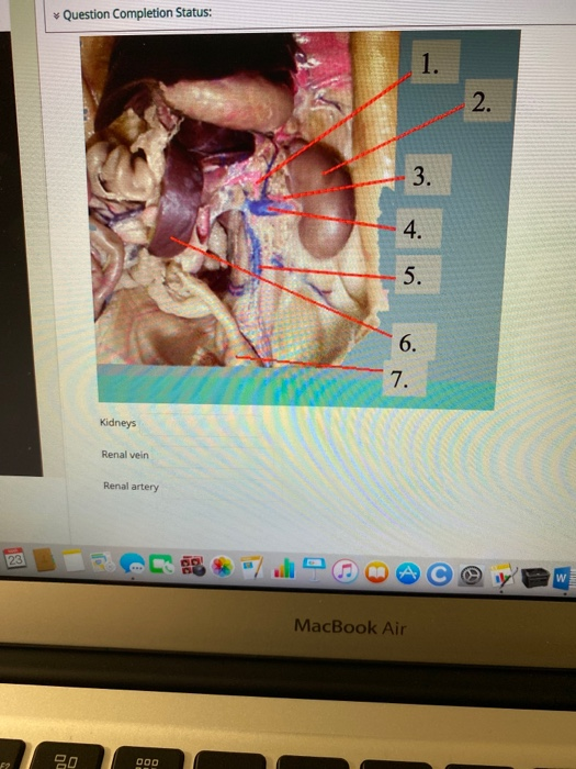 Solved Question Completion Status: Kidneys Renal vein Renal | Chegg.com