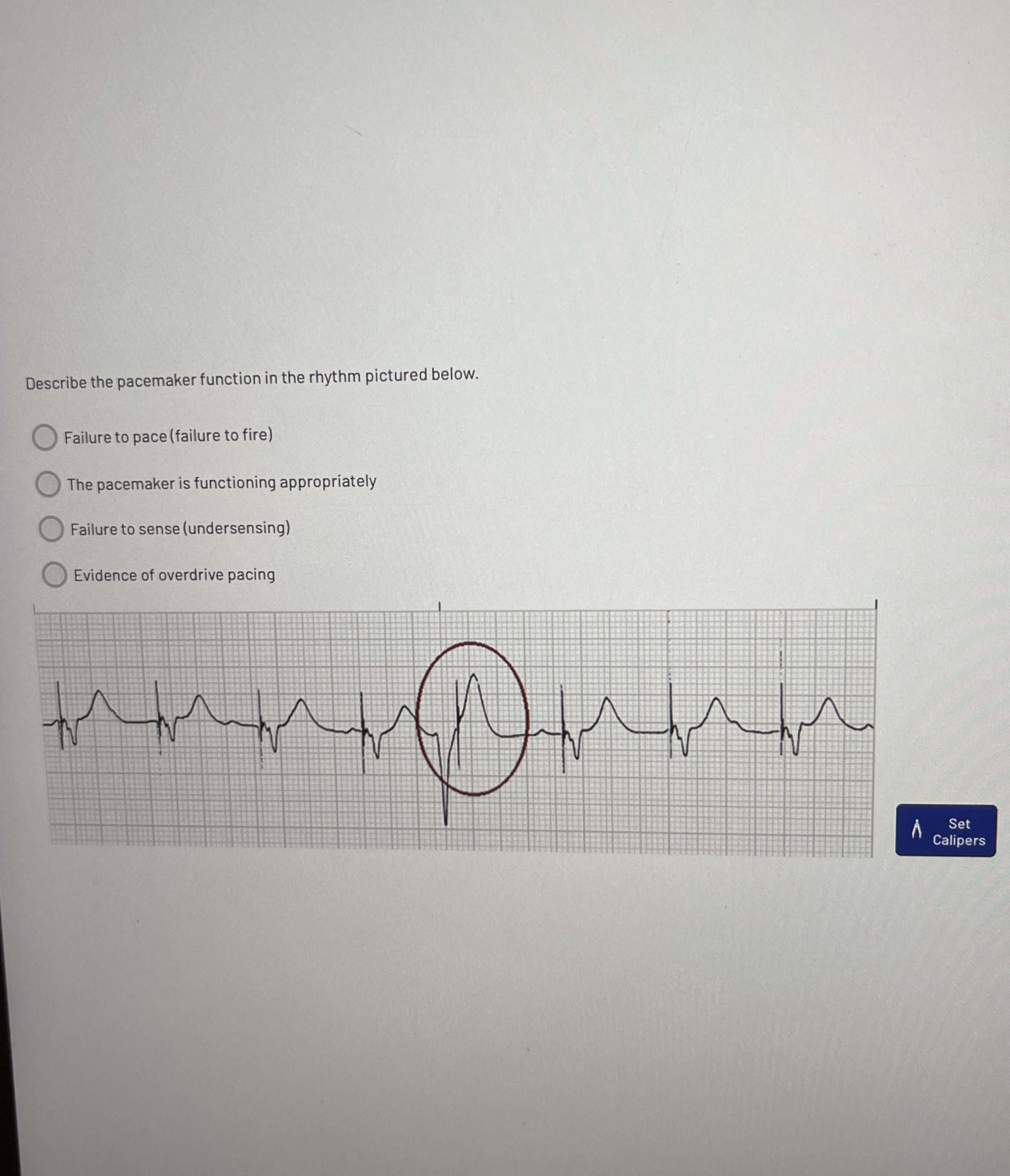 Solved Describe the pacemaker function in the rhythm | Chegg.com