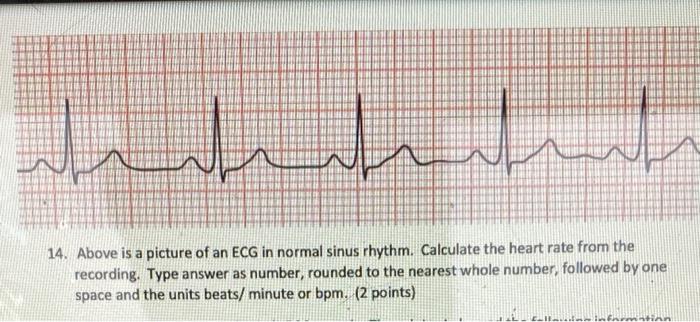 Solved As they studied a normal ECG recording, Ling asked | Chegg.com