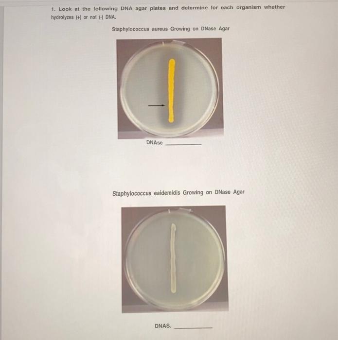 Solved 1. Look at the following DNA agar plates and | Chegg.com