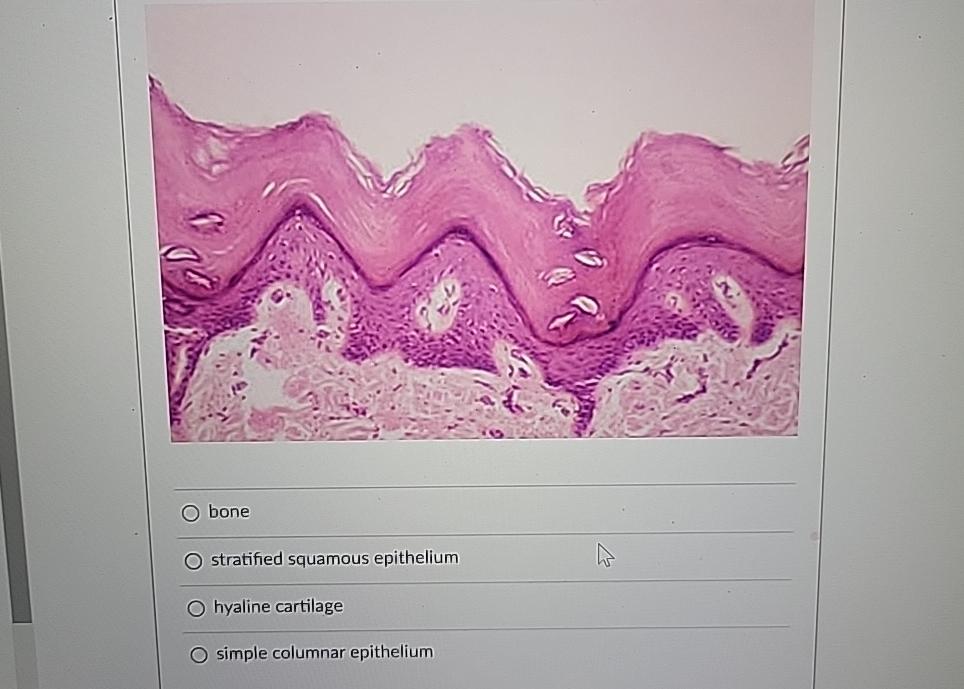 Solved boneO stratified squamous epitheliumO hyaline | Chegg.com