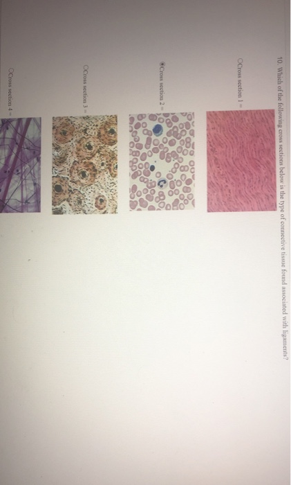 Solved 10. Which of the following cross sections below is | Chegg.com