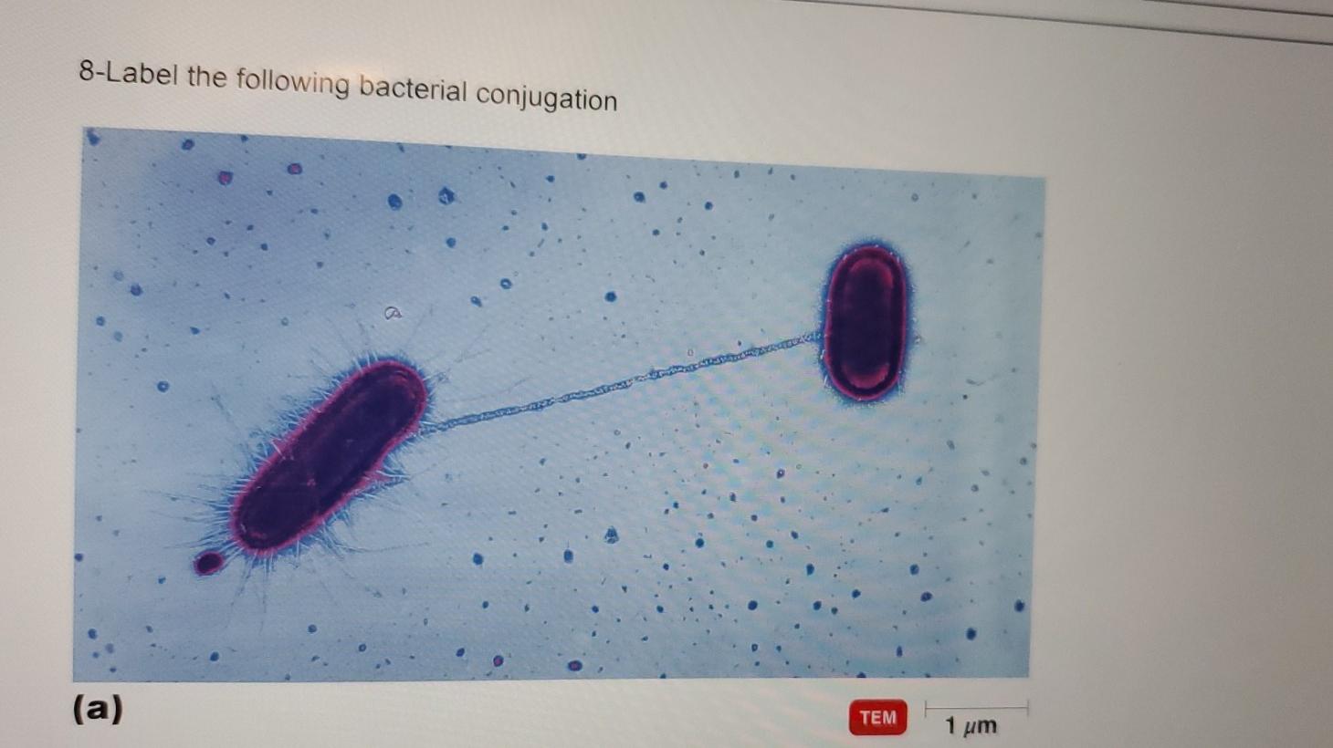 Solved 8-Label the following bacterial conjugation (a) TEM 1 | Chegg.com