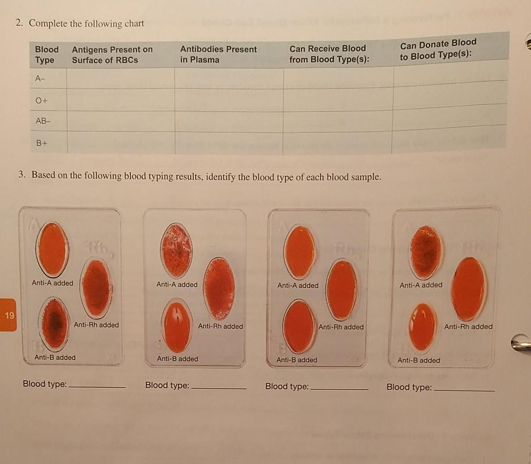 Blood Type Chart Antigens Antibodies