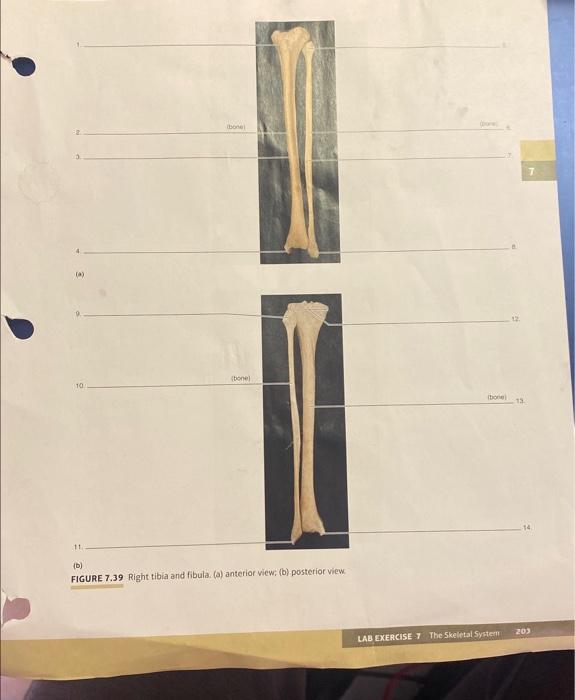 Solved (b) FIGURE 7.39 Right tibia and fibula, (a) anterior | Chegg.com