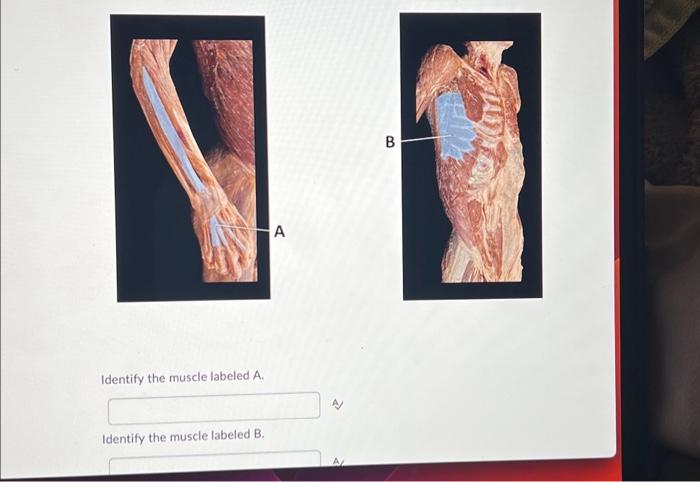 Solved Identify the muscle labeled 10. Identify the muscle | Chegg.com