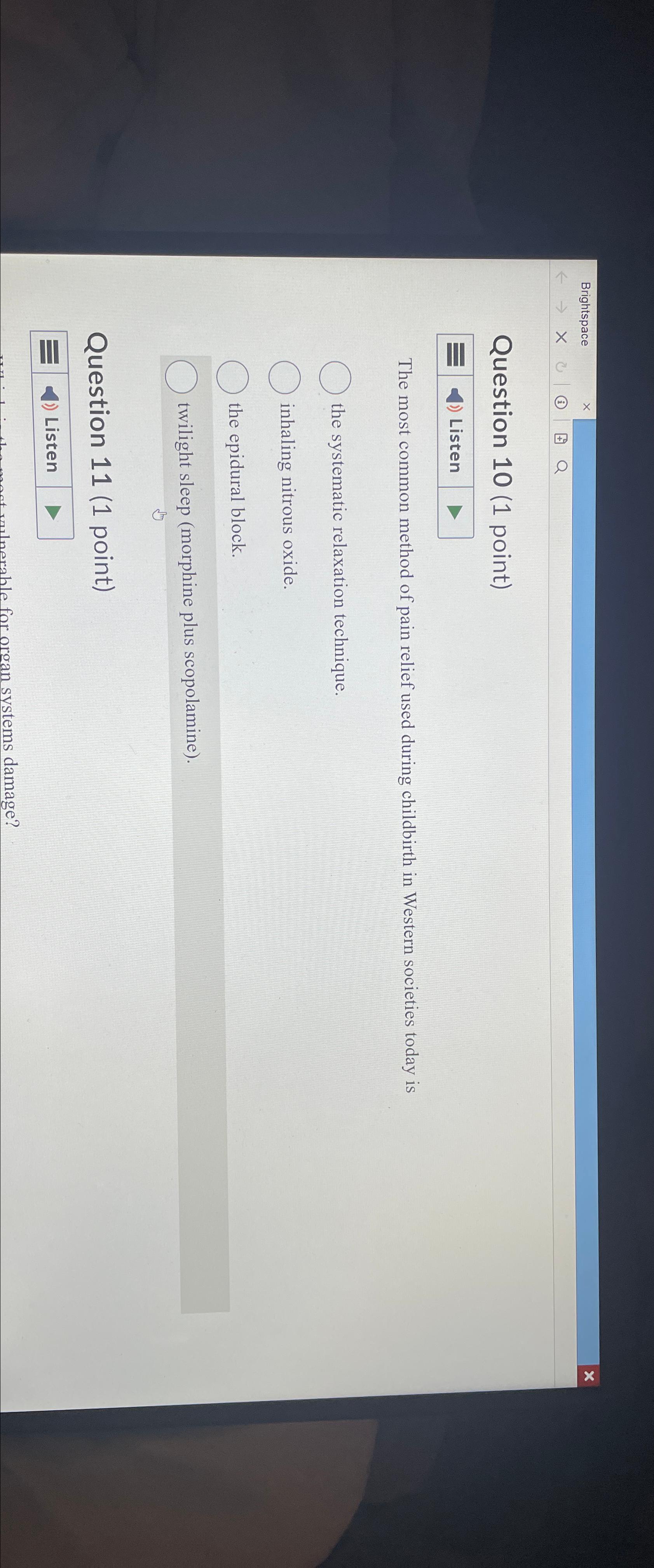 Solved Brightspacex×(i) QQuestion 10 (1 ﻿point)The most | Chegg.com