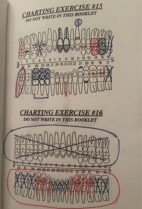 CHARTING EXERCISE \#13 CHARTING EXERCISE \#14 DONOT | Chegg.com