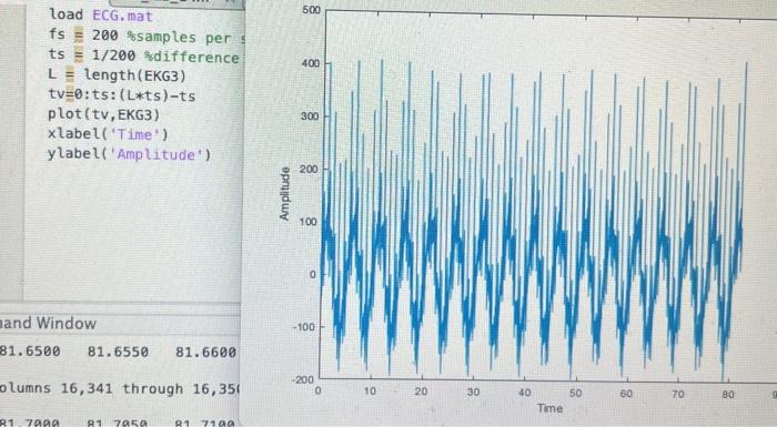 Solved thisnis my matlab code so far to plot my ecg data. | Chegg.com