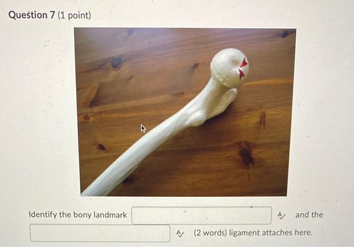 Solved Question 7 (1 point) Identify the bony landmark A and | Chegg.com