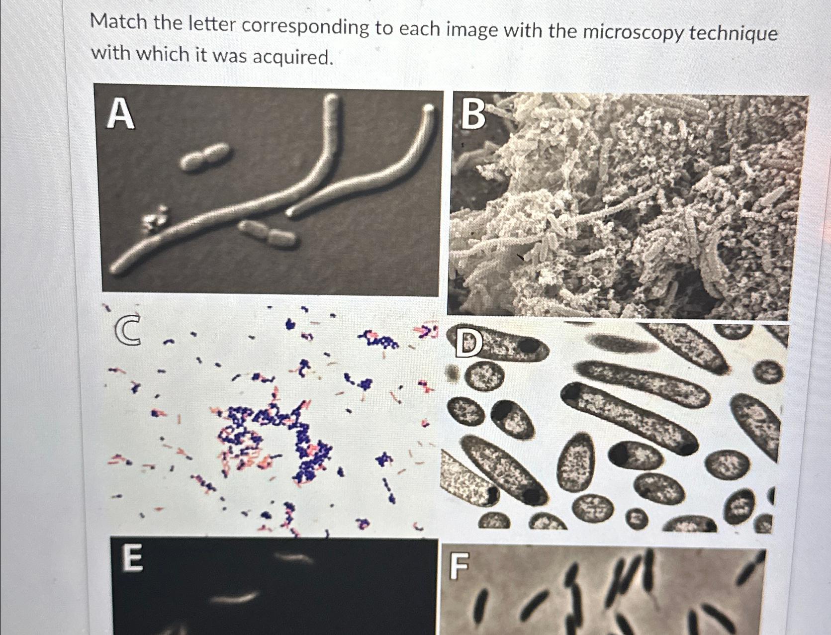 Solved Match the letter corresponding to each image with the | Chegg.com