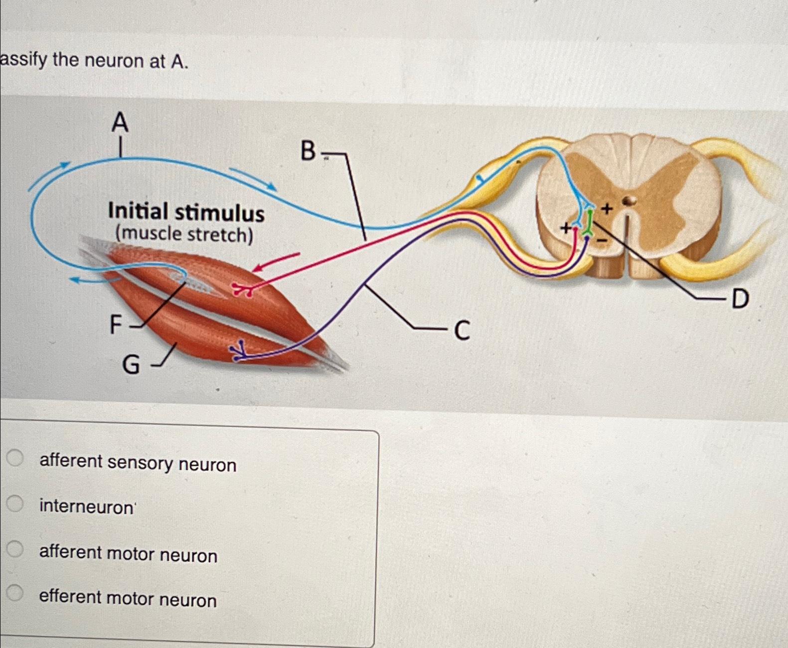 Solved Classify The Neuron At A Afferent Sensory