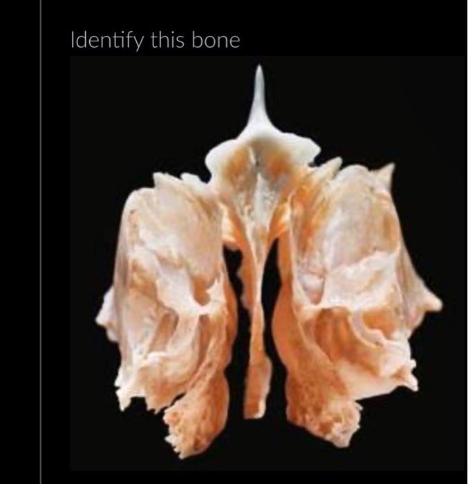 Solved Identify this bone | Chegg.com