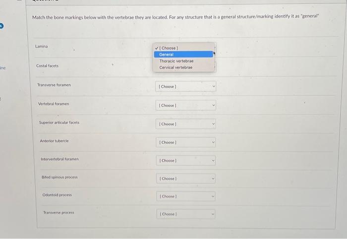 Solved Match the bone markings below with the vertebrae they | Chegg.com