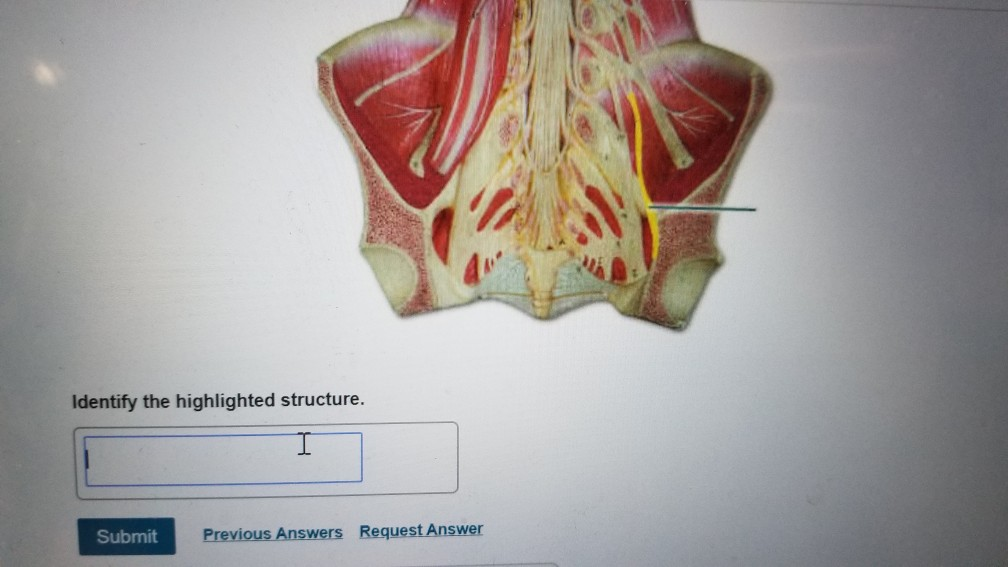 Solved Identify the highlighted structure. Submit Previous | Chegg.com