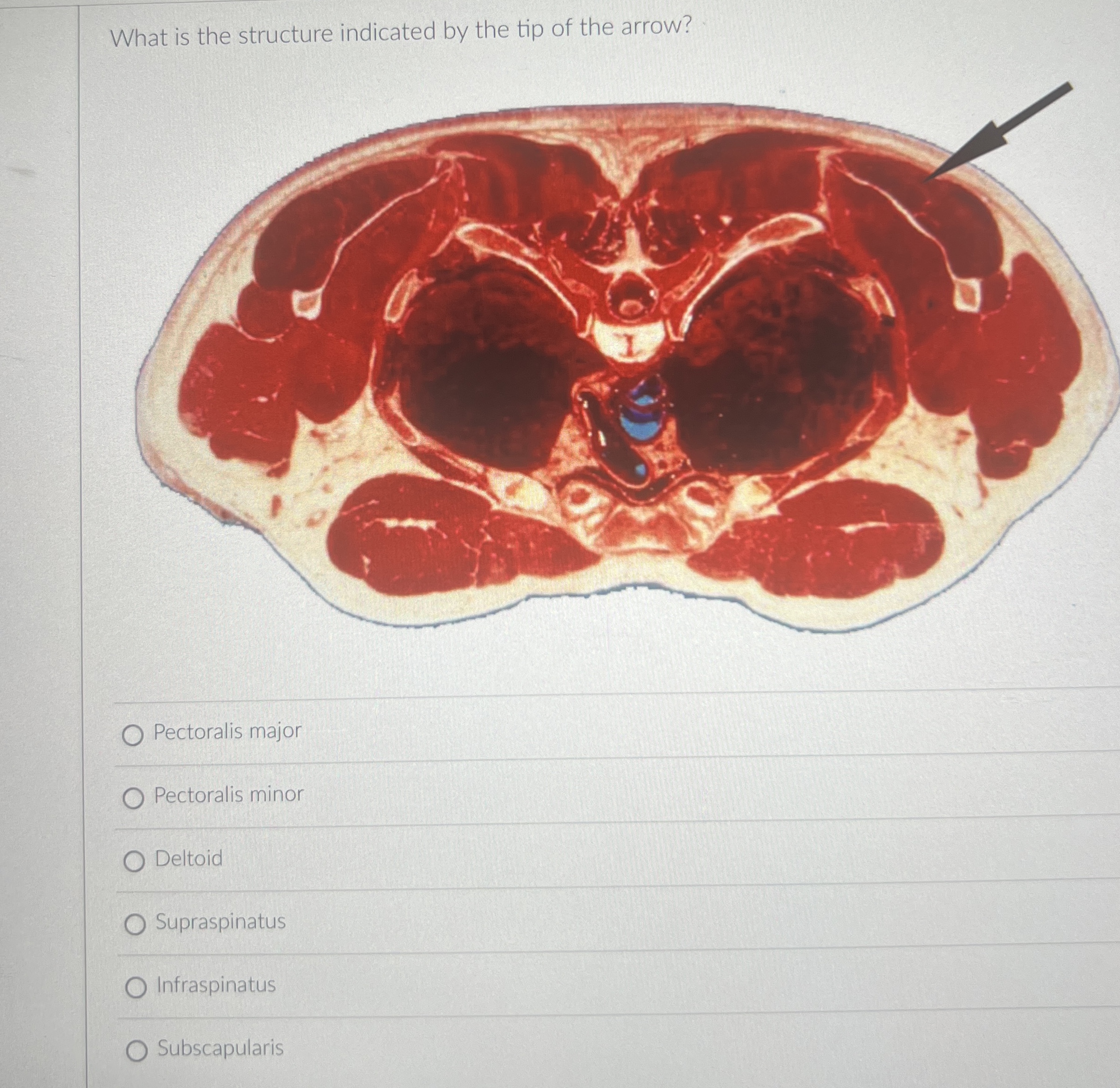Solved What is the structure indicated by the tip of the | Chegg.com