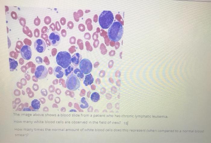 Solved ook $ The image above shows a blood slide from a | Chegg.com