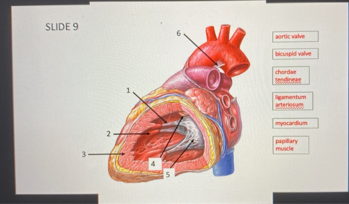 Solved SLIDE 6 left circumflex artery left marginal artery | Chegg.com