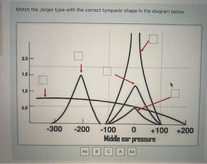 Solved Match the Jerger type with the correct tympanic shape | Chegg.com